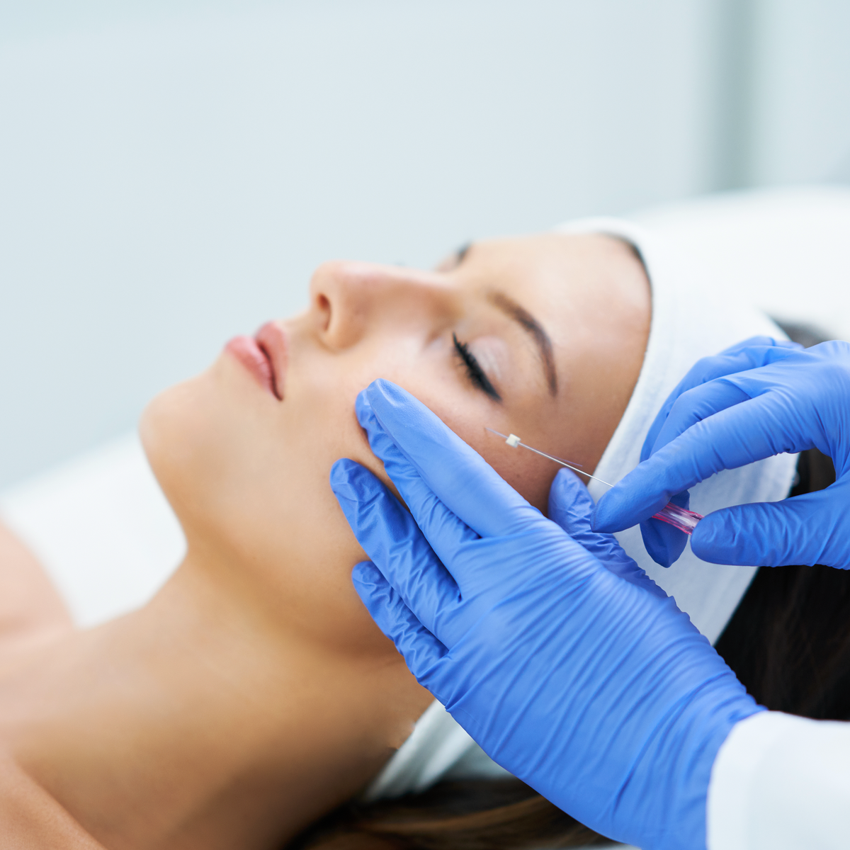 PDO Thread Lift vs Dermal Fillers – Two Face Aesthetics
