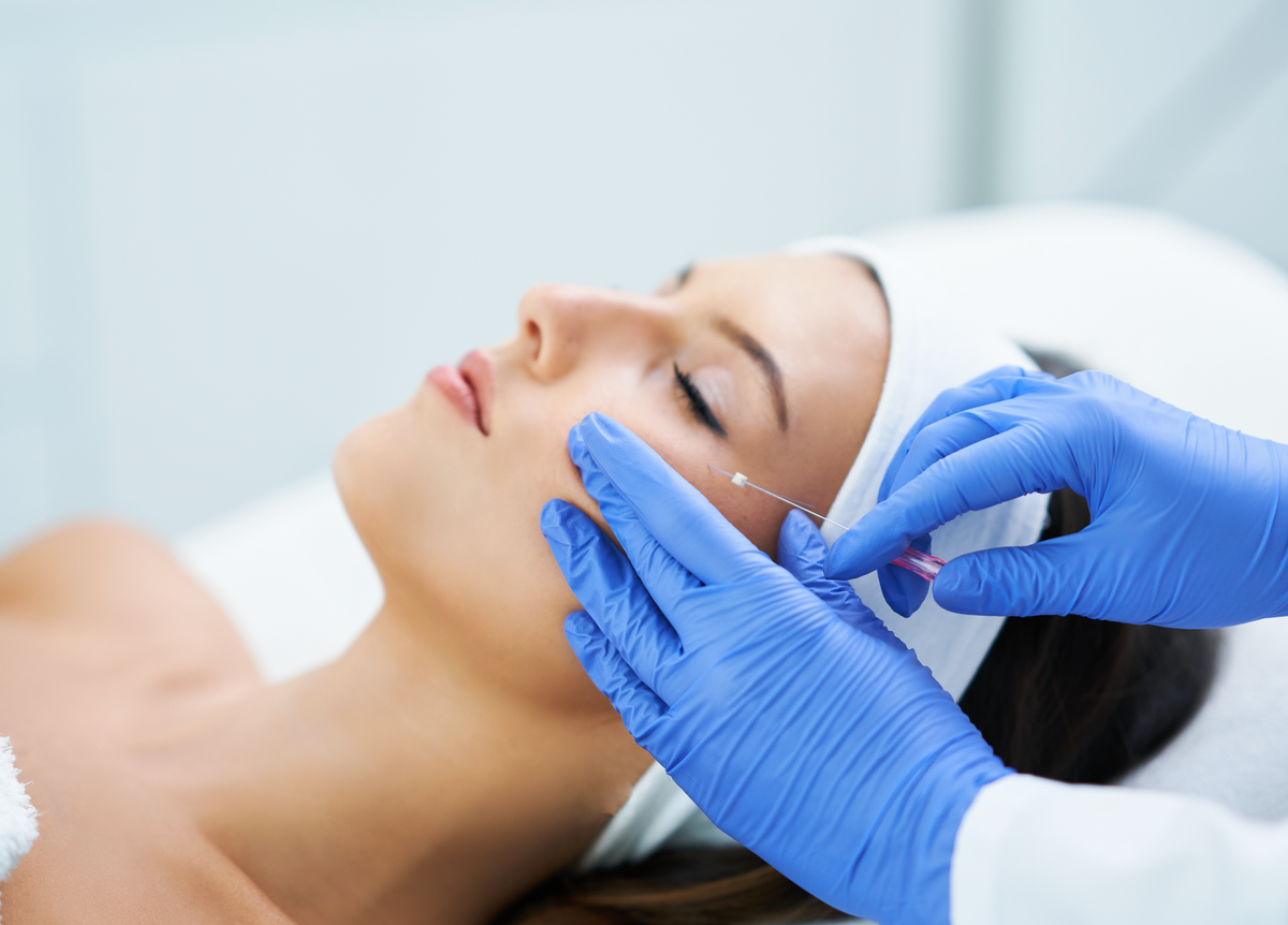 PDO Thread Lift vs Dermal Fillers – Two Face Aesthetics