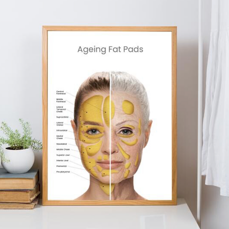 Aging Fat Pad Poster Laminated – Two Face Aesthetics